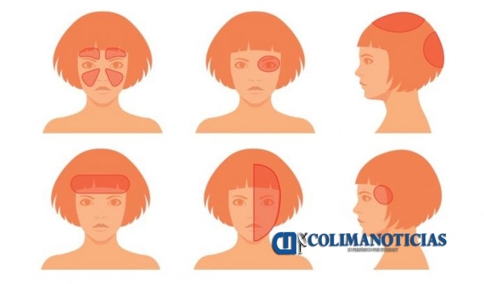 Distintos tipos de dolores de cabeza y cómo eliminarlos | Colima Noticias
